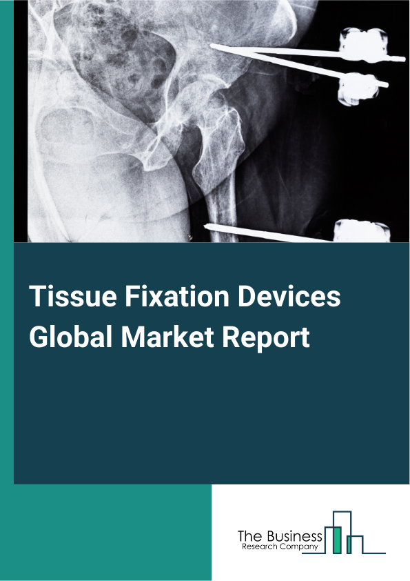 Tissue Fixation Devices Market Size, Trends And Research Report 2025